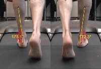 Athlete's Care Toronto Physiotherapy Sports Medicine Doctors ...